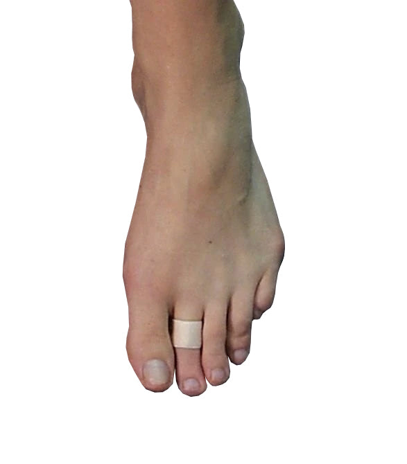 Toe Straightener - Diamond Athletic